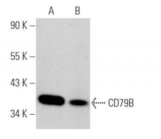 CD79B抗体 (B29/123) | SCBIO - Santa Cruz Biotechnology
